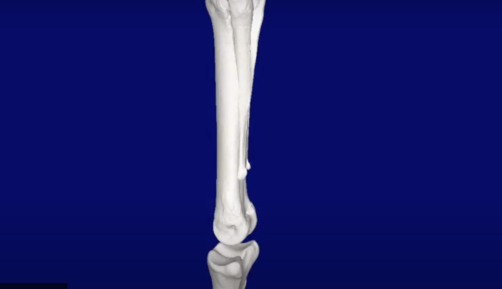 002: Computing the Axis of Rotation from Bone Shape | EponaMind